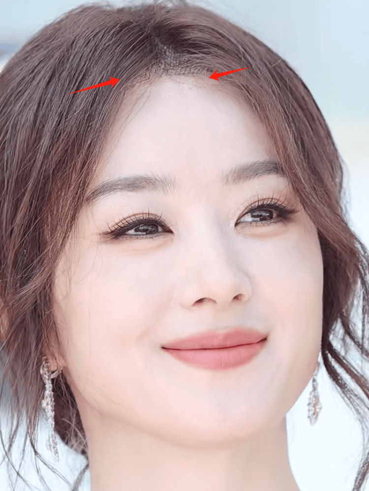 赵丽颖从圆脸变成方脸，出席活动满脸疲倦 - 人在温哥华网 VanPeople.com